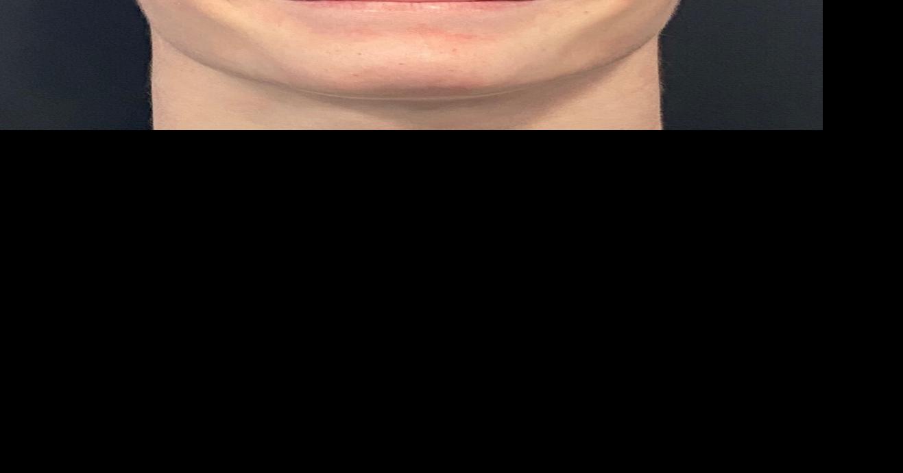 Jake Mann • Ladue wrestling