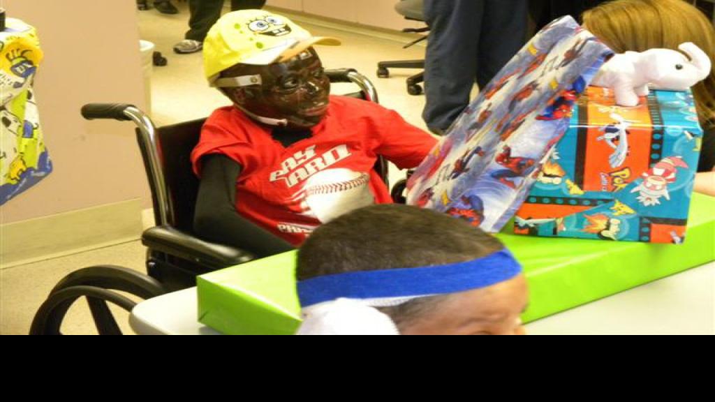 Boy burned in fire returns to St. Louis | Metro | stltoday.com