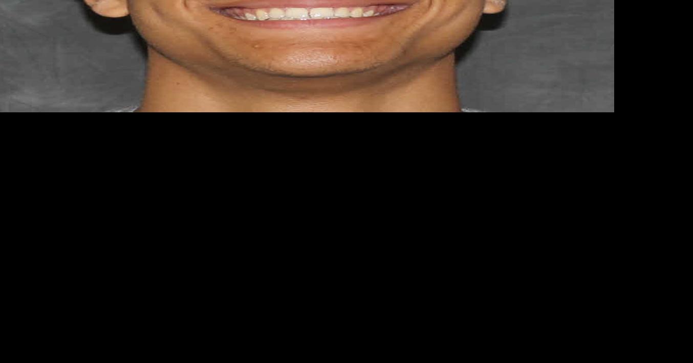 Shaun Riley II • O’Fallon basketball