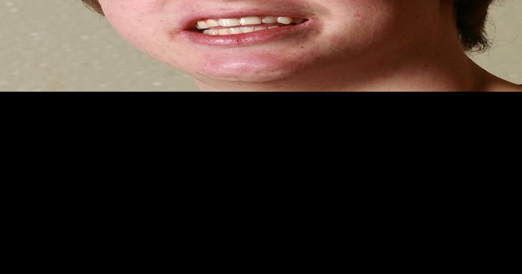 Nolan Berry, 6-9, sr., F, De Smet