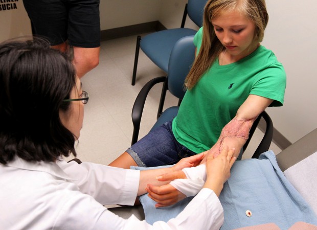 Recovering from a severed arm