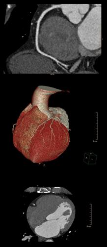 Holy Cross Hospital Improves Noninvasive Diagnostics with New CT ...