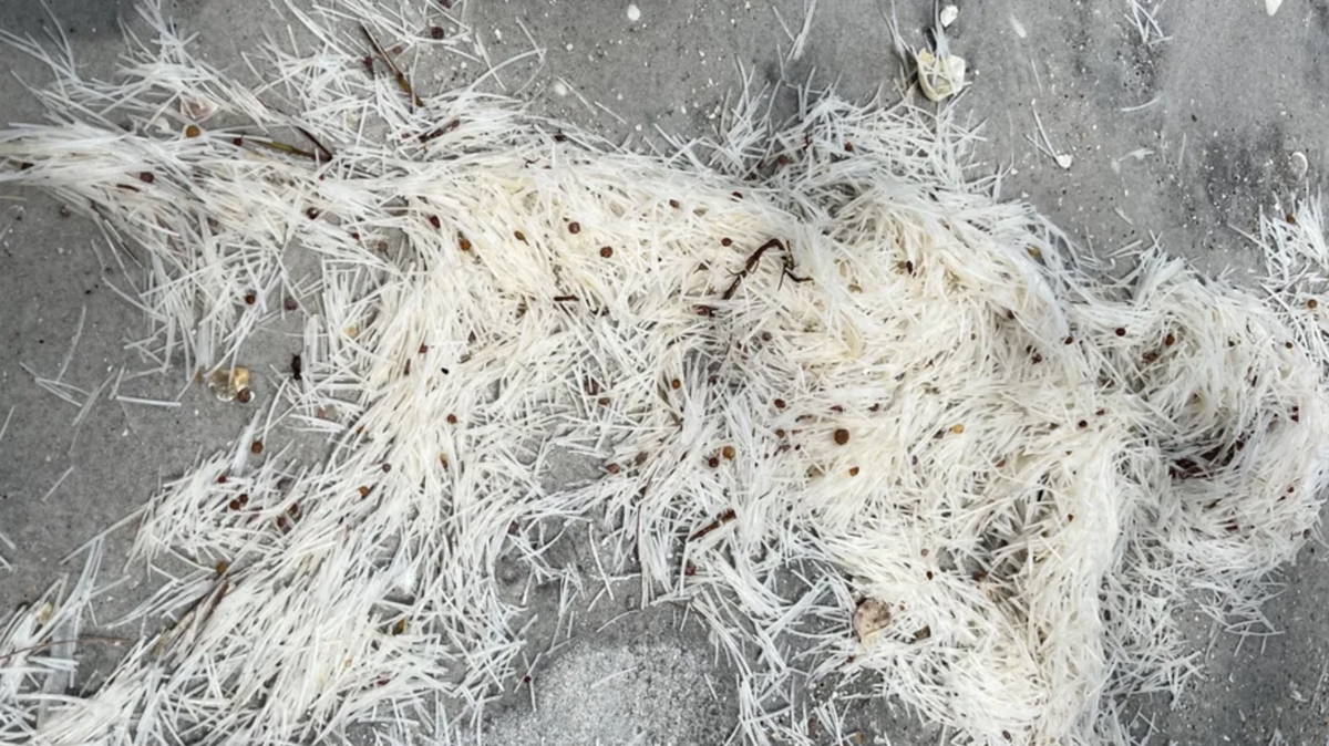 white stringy stuff from mouth