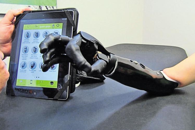 i limb touch bionics