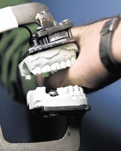 ted bundy bite evidence