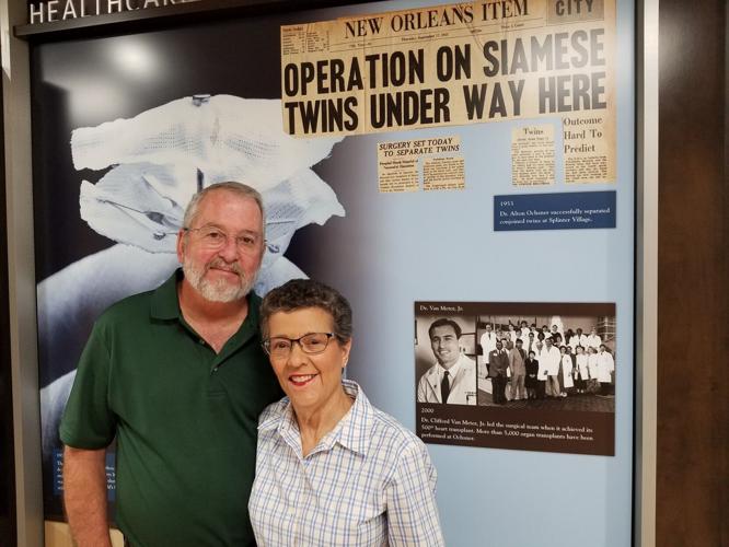 Conjoined Mouton twins from Lafayette, La survived surgery ...