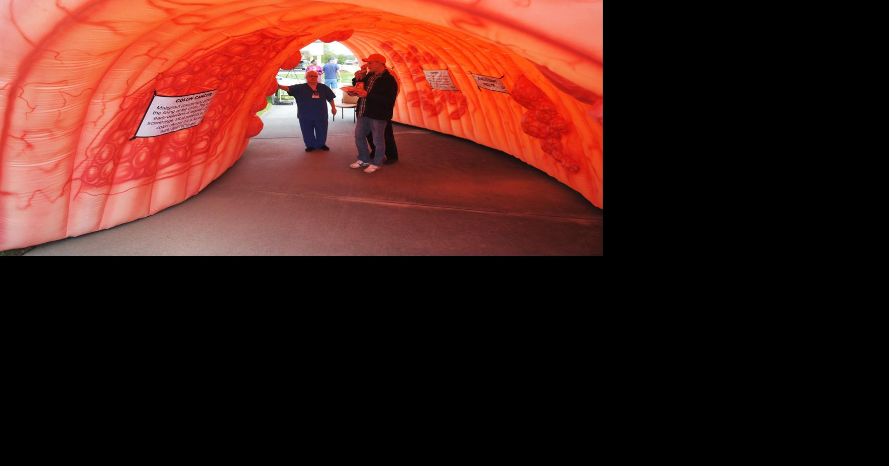 Photos: Giant, walkthrough colon raises awareness during Colorectal ...
