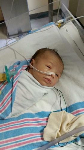 Baby Briggs needed three liver transplants before he turned 1. Here's ...