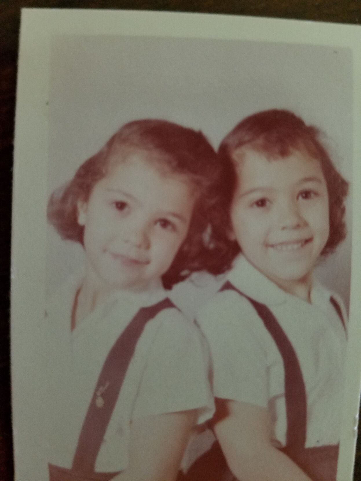 Conjoined Mouton twins from Lafayette, La survived surgery ...