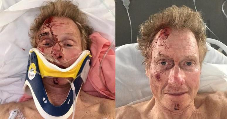 WWL Radio host 'Scoot' injured in hit-and-run; police seek info on ...