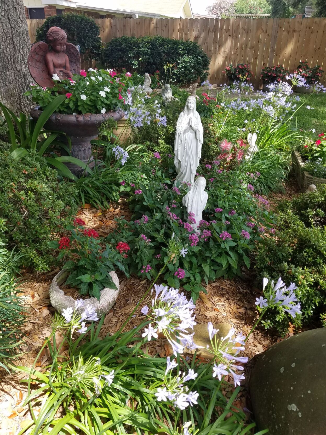 Conjoined Mouton twins from Lafayette, La survived surgery ...