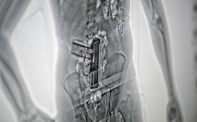 St. Martin Parish X-ray machine will stop contraband coming inside jail ...