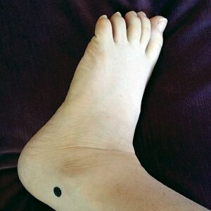 Bladder 60 excellent for relief of pain in joints and muscles | Health ...