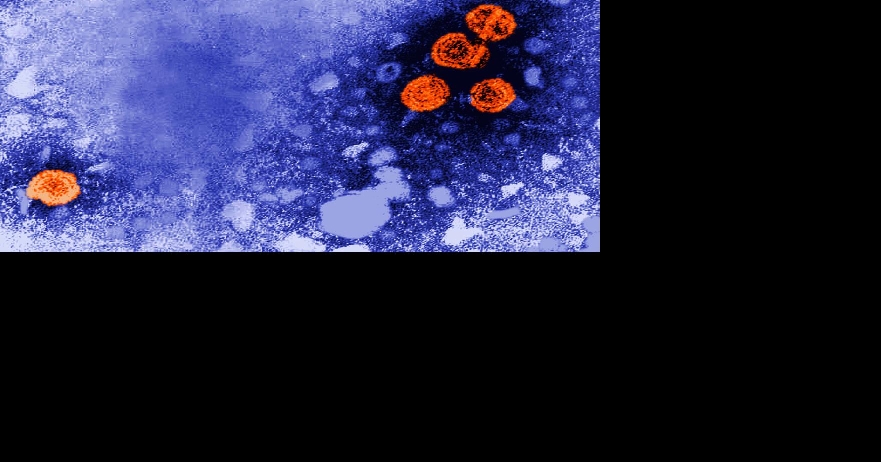 Guinea-Bissau suspends Trump-backed hepatitis B vaccine study for ...