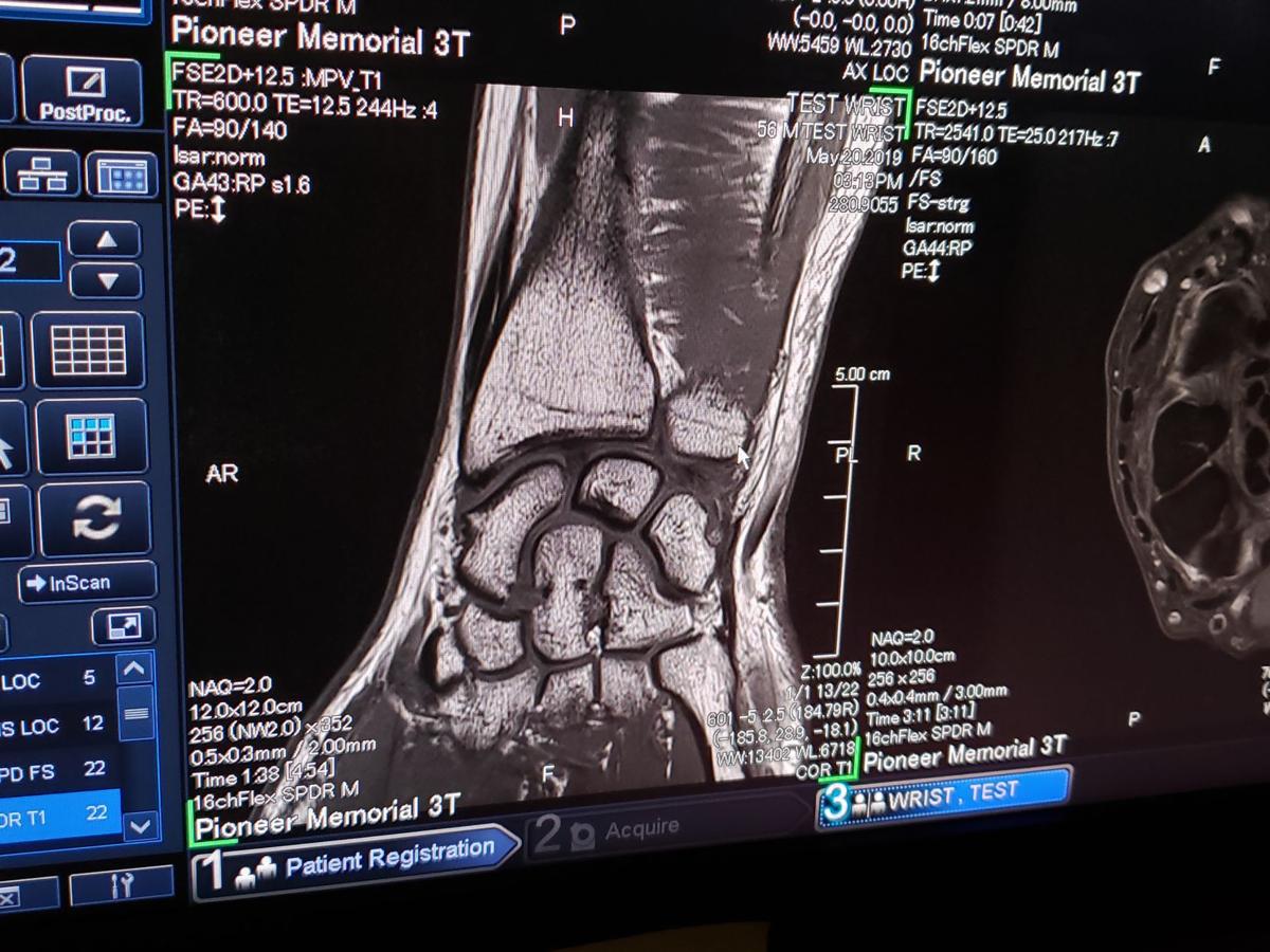 Pioneers unveils the 3 Tesla MRI | Health | thedesertreview.com