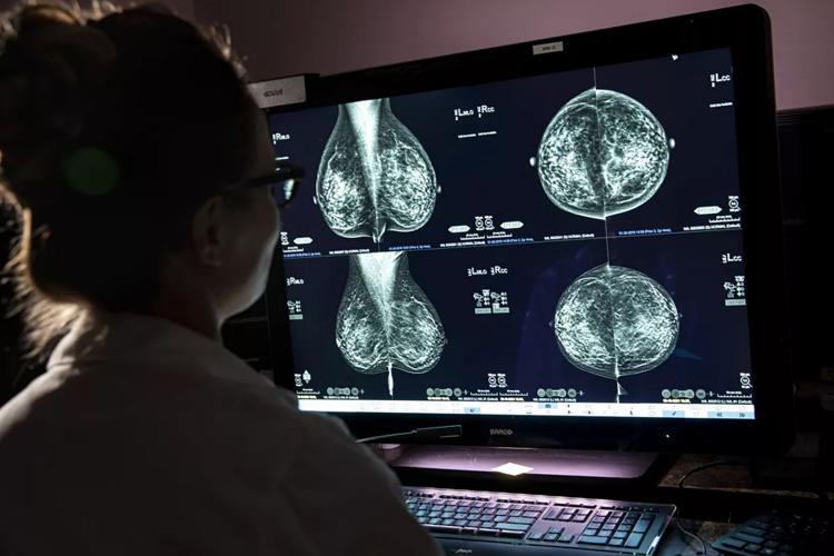 Medical panel says mammograms should start at 40 years old | News ...