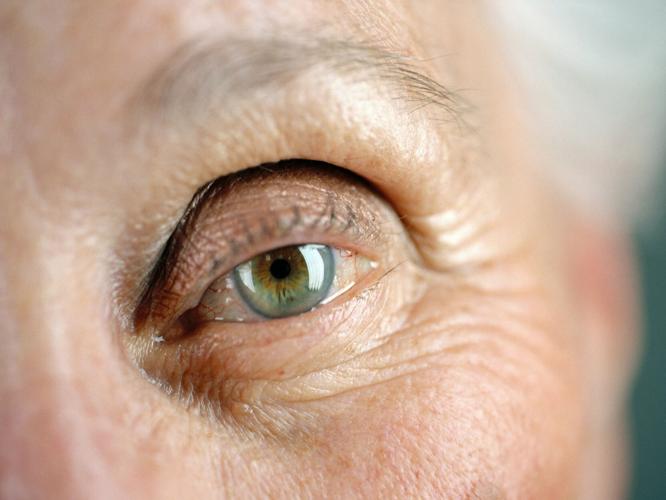 Aging eyesight: Explaining vision issues and treatment | Lifestyles ...