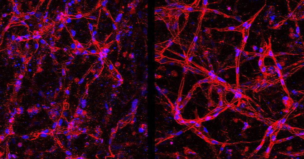 Stem cell breakthrough offers fresh hope for treating blindness ...