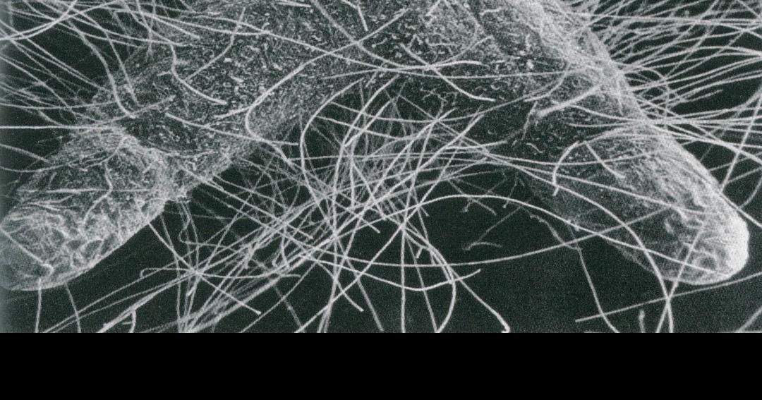 Jim Janke's experiment with Myco, the wonder fungus | News ...