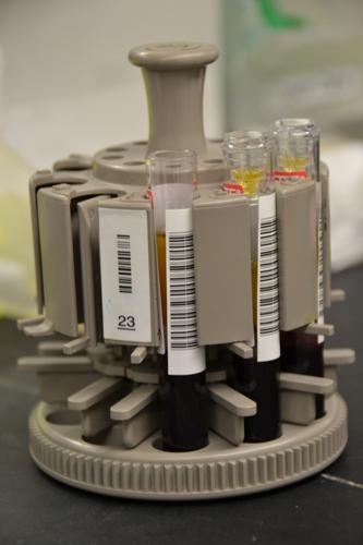 New law allows local blood testing | News | themountaineer.com