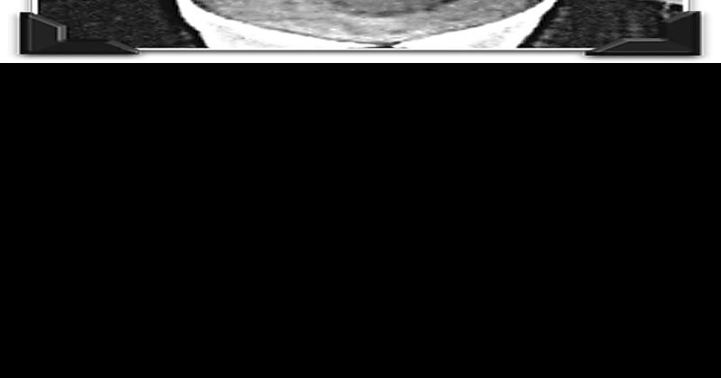 "King" Kelly Coleman | Basketball Preview | thenewsenterprise.com