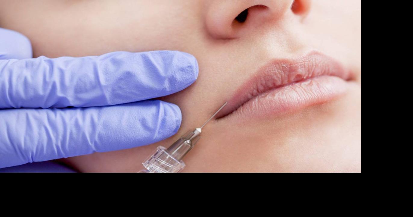 Fillers 101: Everything You've Ever Wanted to Know | Beauty ...