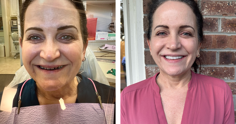 Get a New Smile Fast with Same-Day Enhancements | | thepilot.com