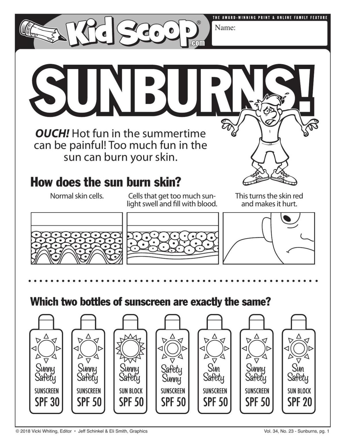 Sunburns | Kid Scoop | thepress.net