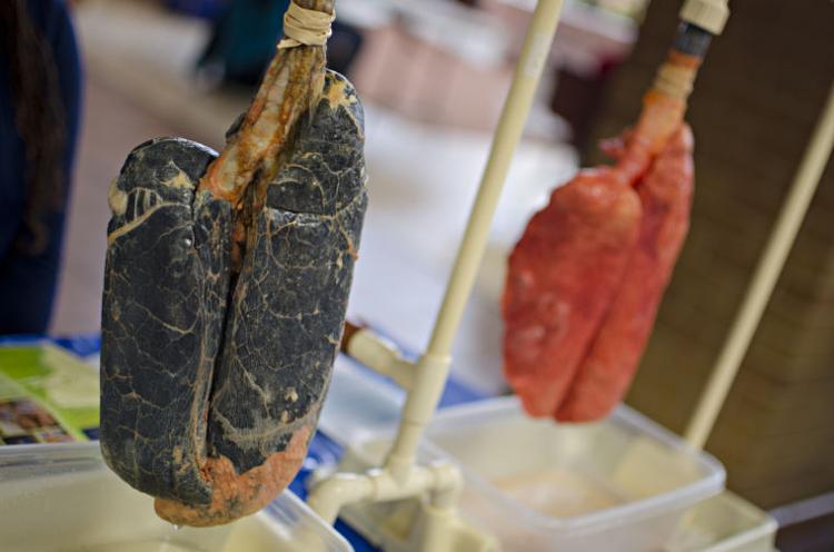 Black pig lungs snuff urge to smoke | News | theshorthorn.com