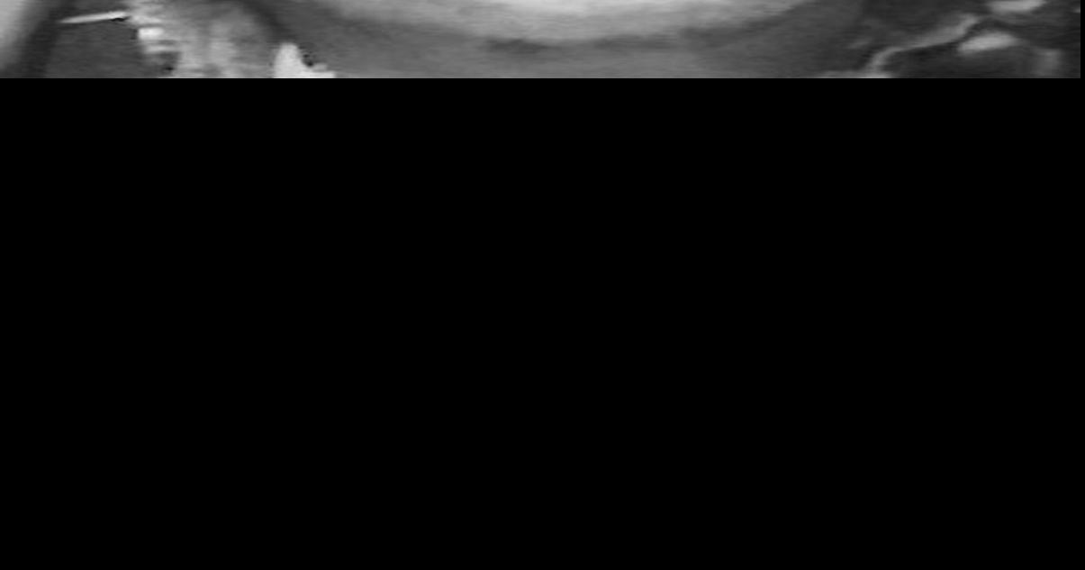 Kenneth Pate | Obituaries | times-georgian.com