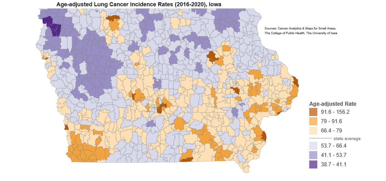 University of Iowa researchers create tools for cancer tracking in ...