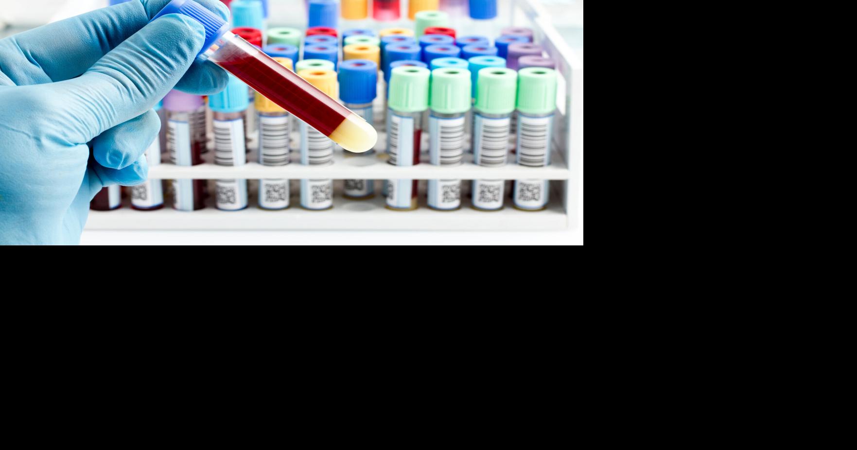 MAYO CLINIC MINUTE: What high triglycerides mean and why it matters ...