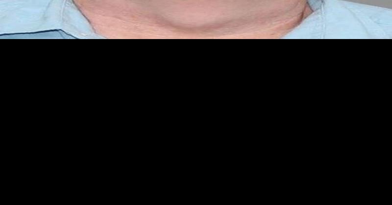 Toronto doctor charged with sexual assault | Crime | toronto.com