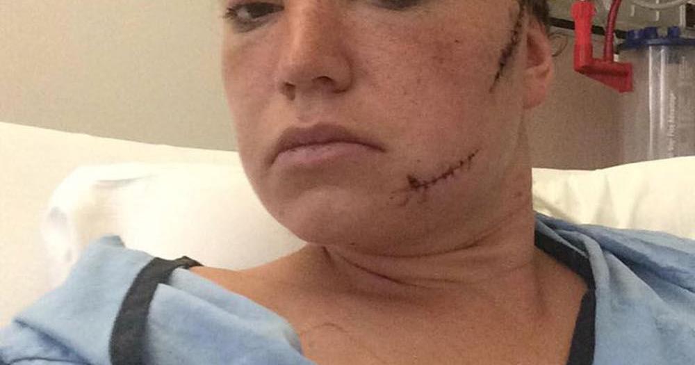 Victim in random face slashing in east-end Toronto turns to social ...
