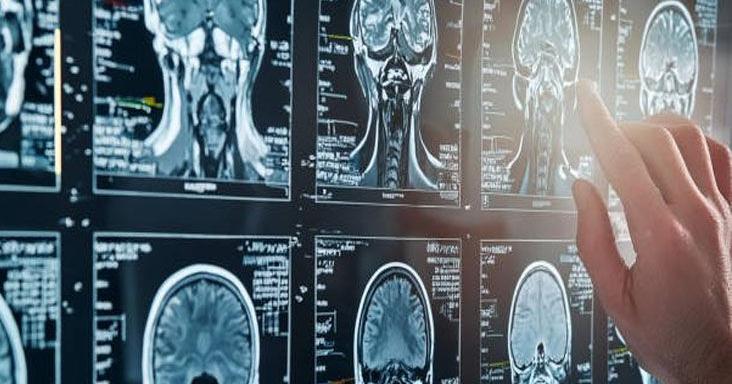 Understanding MS | Features Local | trinidadexpress.com