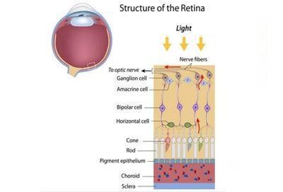retinal detachment structure
