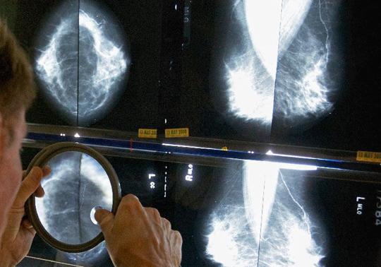 When to get a mammogram? | Features Local | trinidadexpress.com