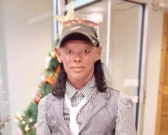 Devan's short, painful, meaningful life | News Extra | trinidadexpress.com