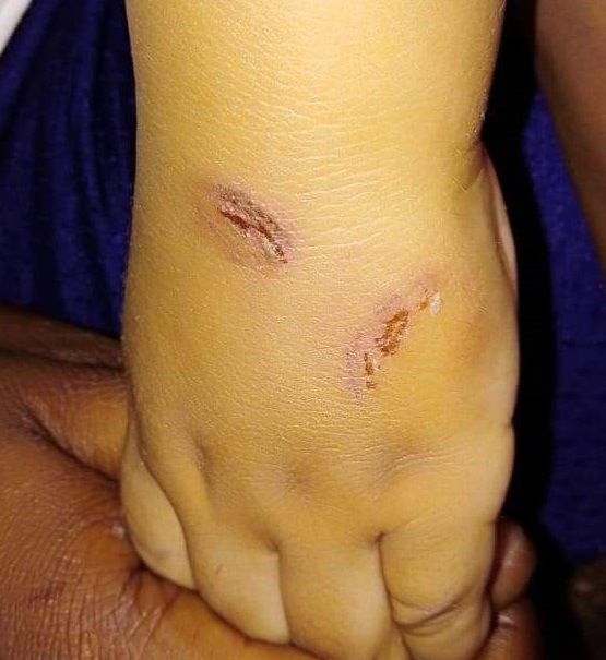 Baby beaten at daycare centre | Local News | trinidadexpress.com