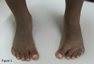 Podopaediatrics...foot care for children* | Local News ...