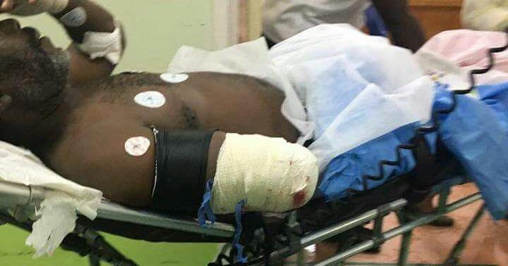 Man loses arm while driving | Local News | trinidadexpress.com