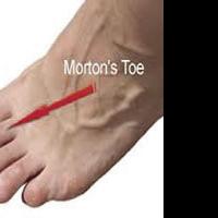 Mortons Toe | Local News | trinidadexpress.com