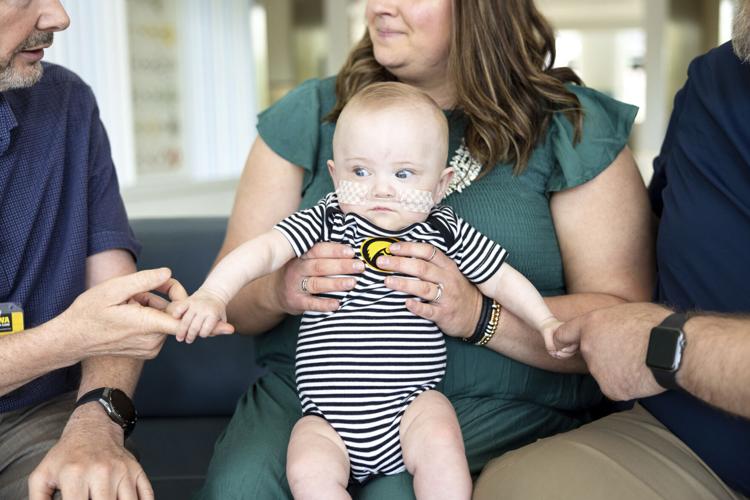 Baby born weighing 10 ounces sets record with 1st birthday