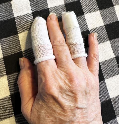 Beware the menacing mandoline — a cautionary tale | Local | union ...