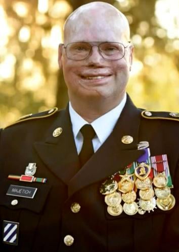 Walla Walla man's brother sets a world medical first | Etcetera | union ...