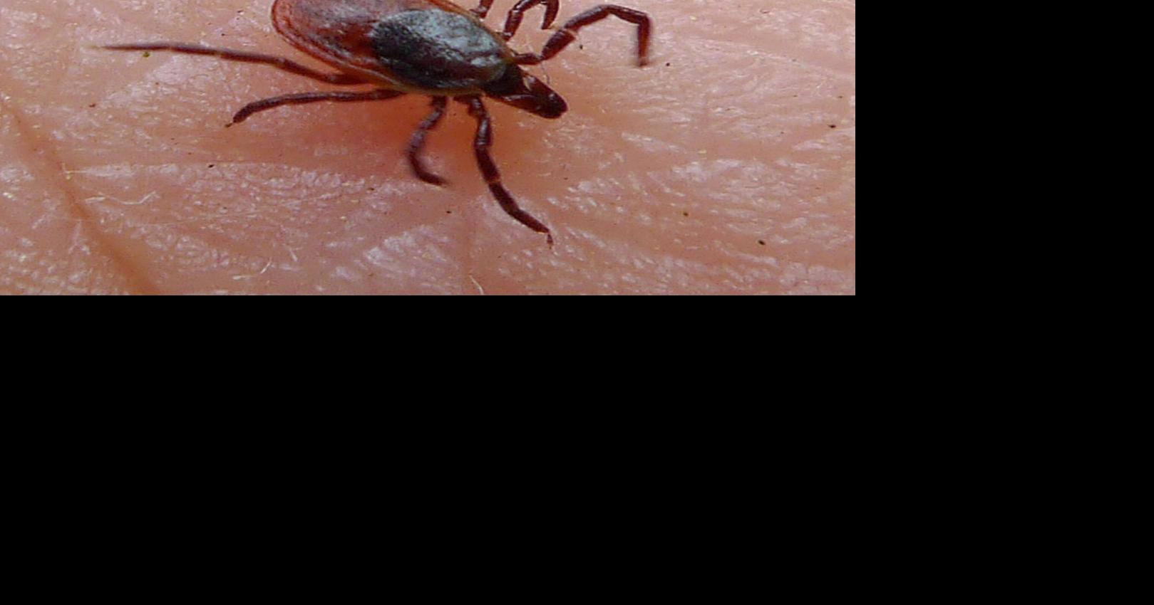 Ticked off: Threat of tick-borne illness on the rise | Health ...