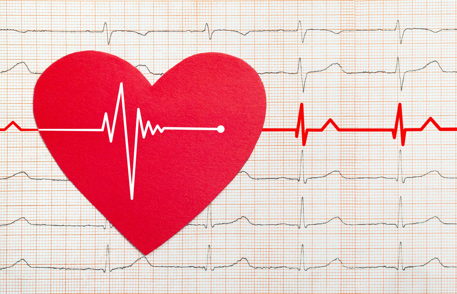 Understanding your heart test: What to expect, how to prepare | Health ...