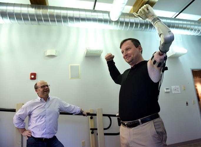 Luke arm and special surgery gives amputees better movement | Science ...