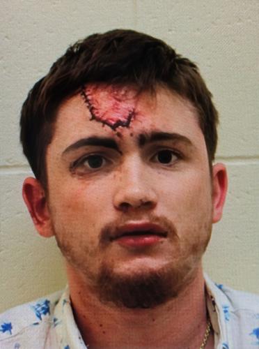 Hudson man, 19, charged with intentionally causing fatal Litchfield ...