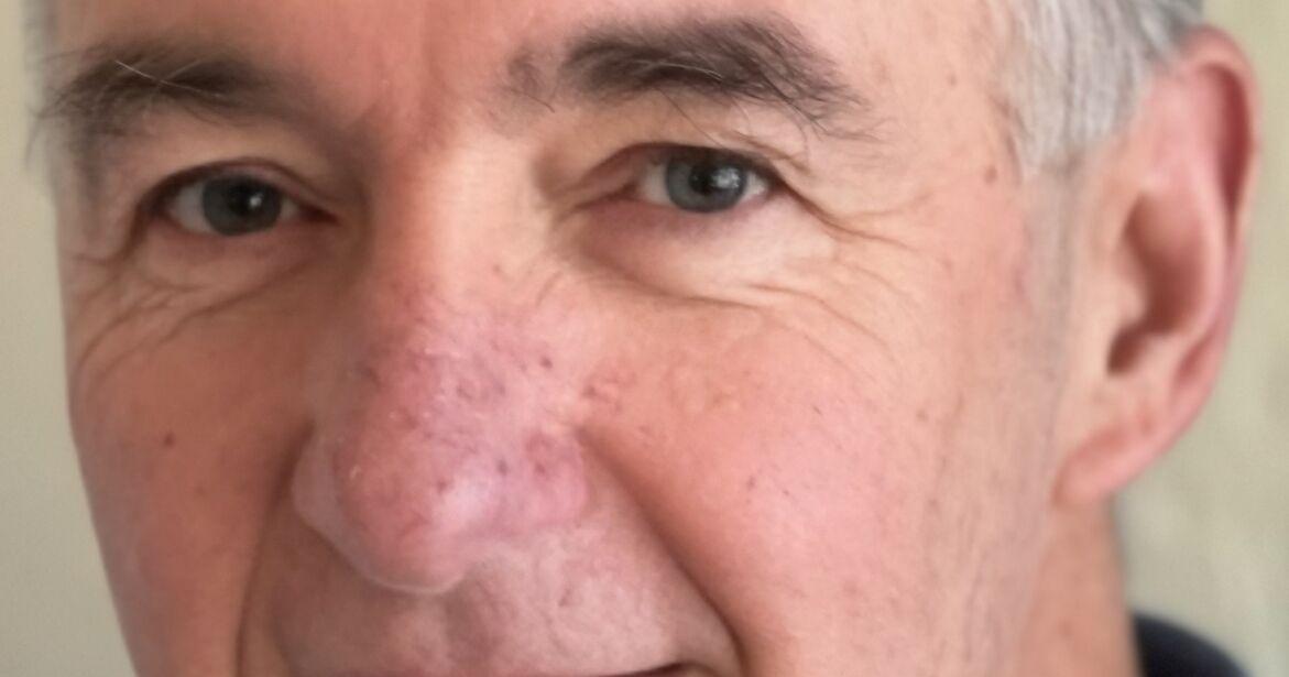 Jack Cheevers: Trump has shown how he supports veterans | Op-eds ...